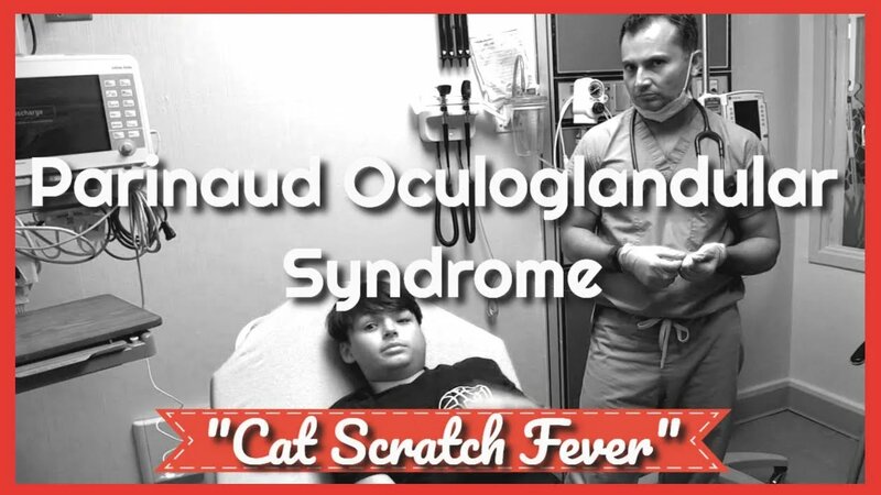Parinaud Oculoglandular Syndrome Emergency - Смотреть онлайн в поиске ...