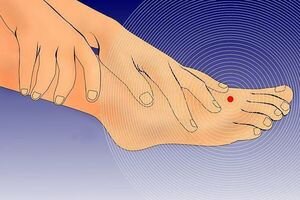 «Причины и лечение онемения ног: бедра, ниже колена, стопы, пятки ...
