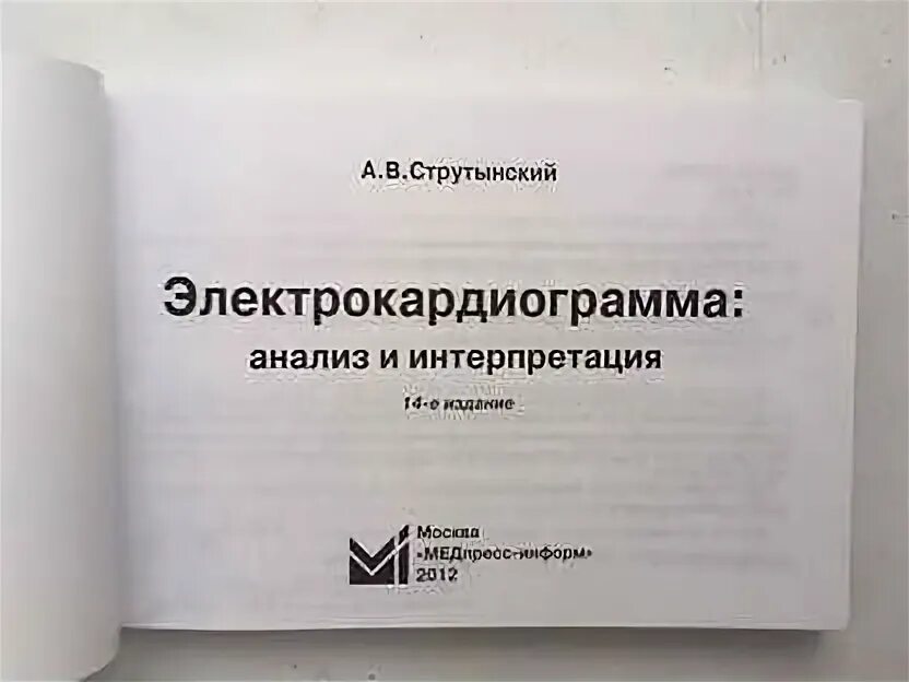 Струтынский экг